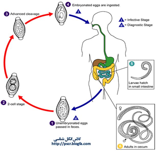 تریشوریس تریشورا Trichuris trichiura